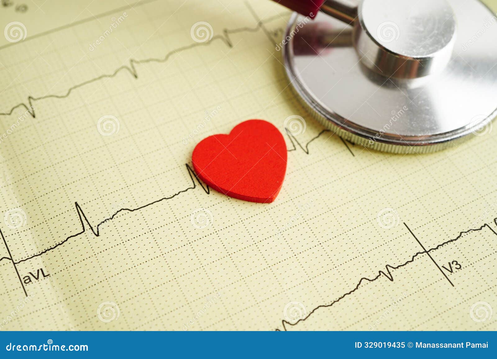 Electrocardiogram (ECG), Heart Wave, Heart Attack, Cardiogram Report ...