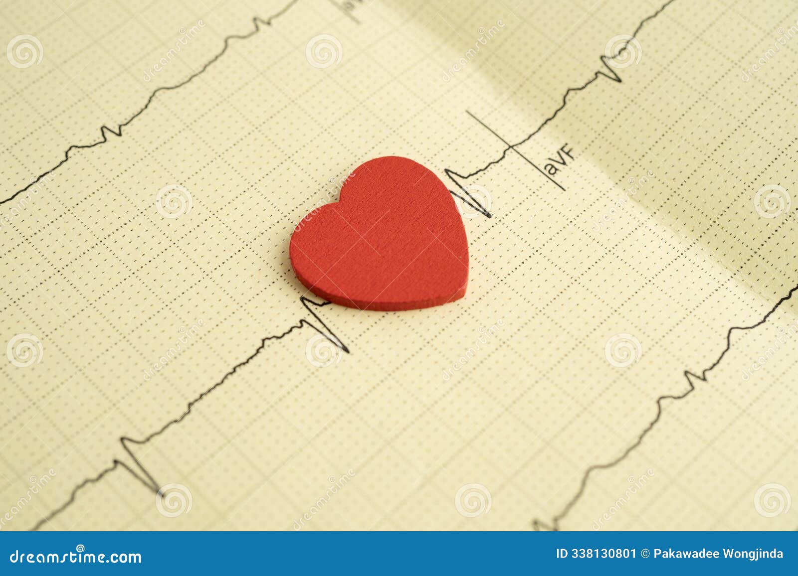 Electrocardiogram (ECG), Heart Wave, Heart Attack, Cardiogram Report ...