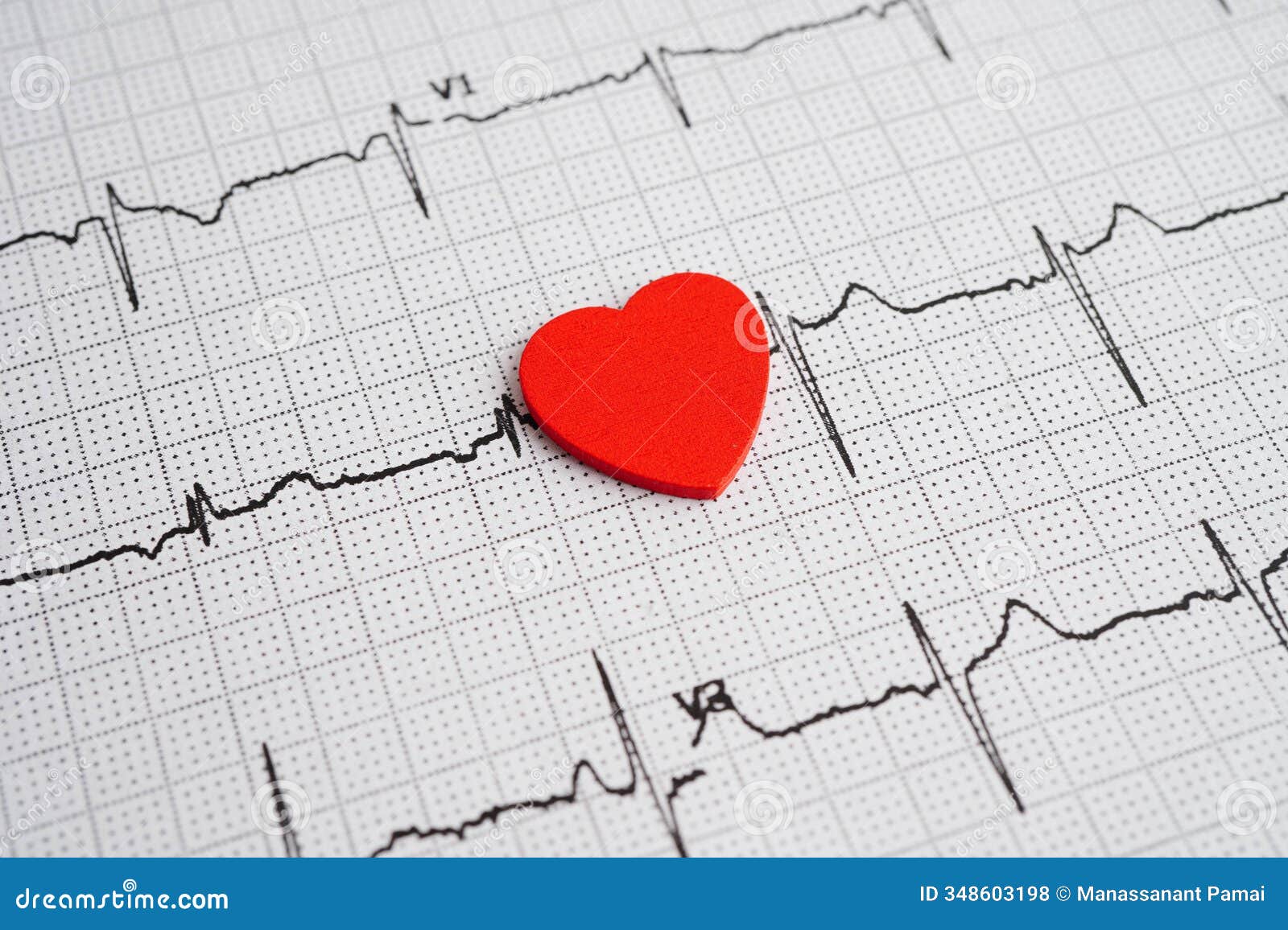 Electrocardiogram (ECG), Heart Wave, Heart Attack, Cardiogram Report ...