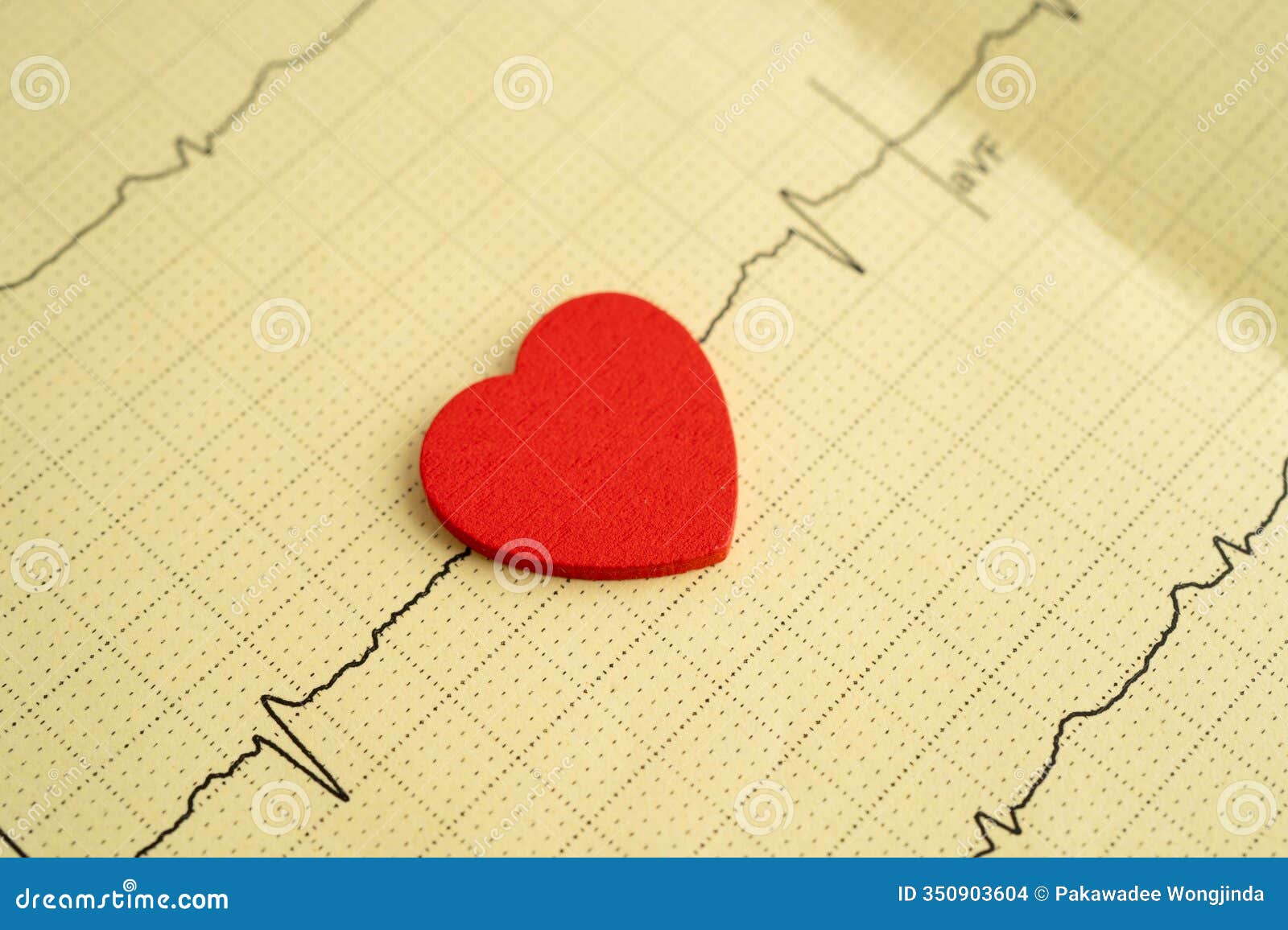 Electrocardiogram ECG, Heart Wave, Heart Attack, Cardiogram Report ...