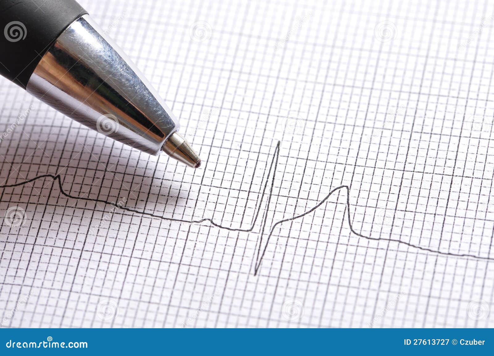 Electrocardiogram graph stock image. Image of points - 27613727