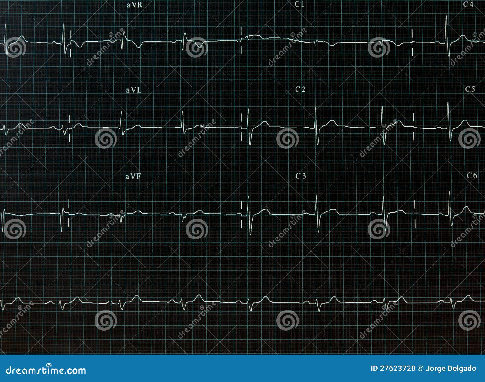 Electrocardiogram Graph Stock Photography | CartoonDealer.com #27623720