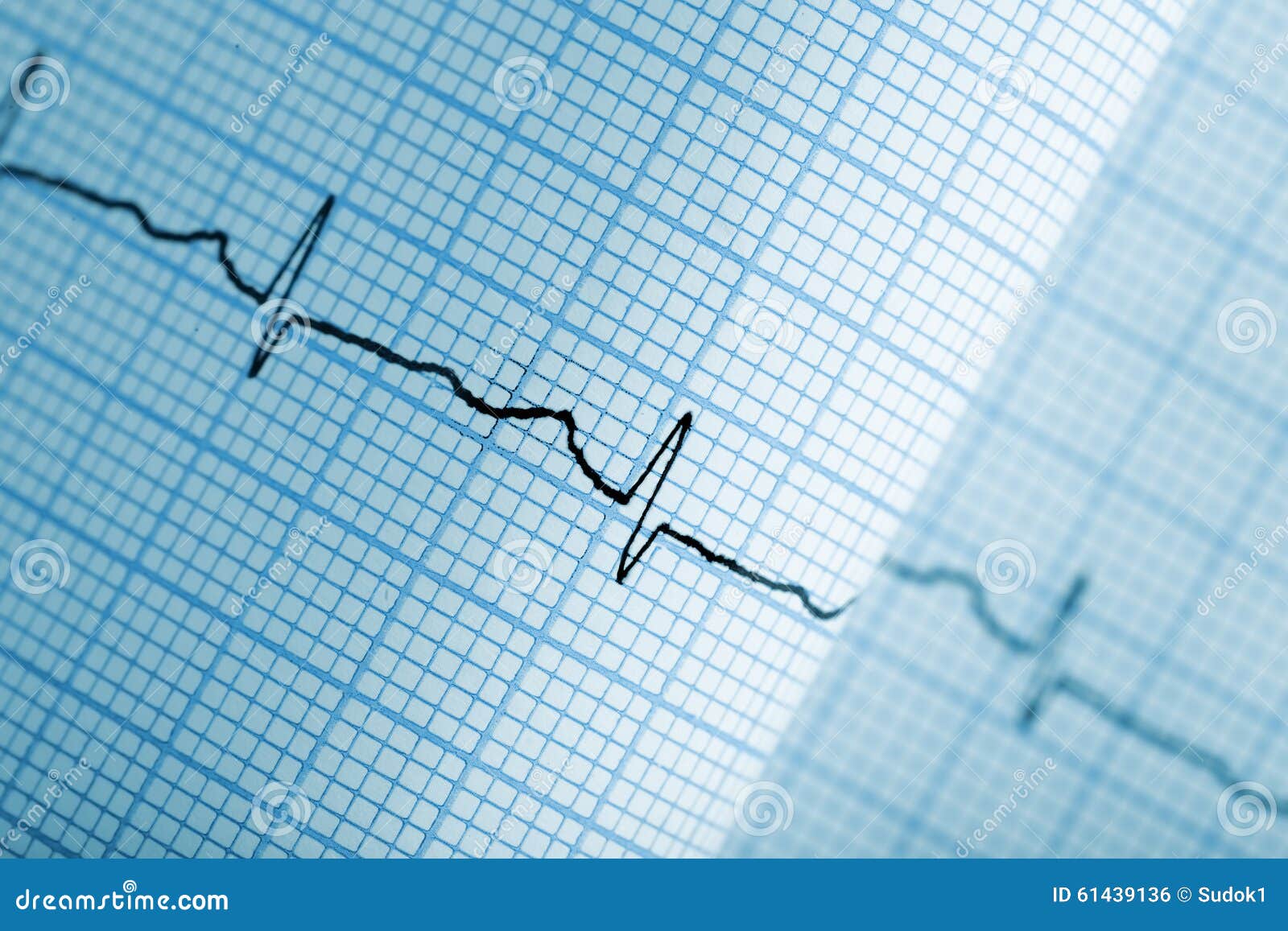 Electrocardiogram Graph on Paper Stock Photo - Image of ...