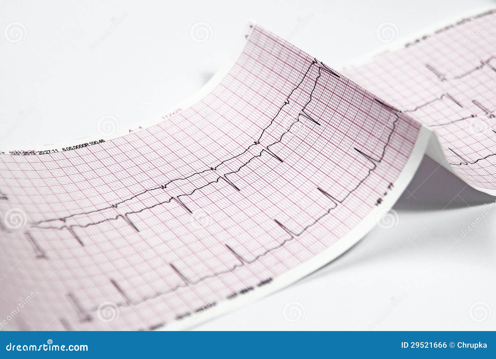 Electrocardiogram, Heart EKG Test Stock Photo - Image of care, examine ...