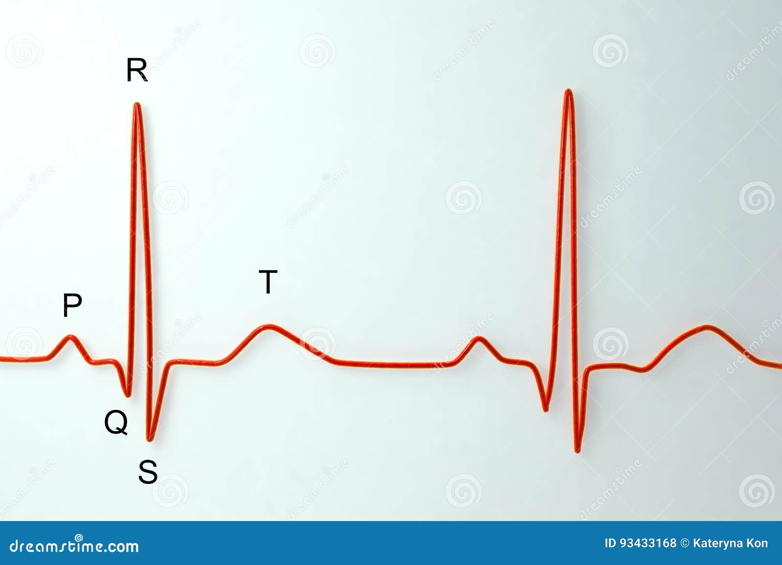 Electrocardiogram with Labeles on Light Background Stock Illustration ...