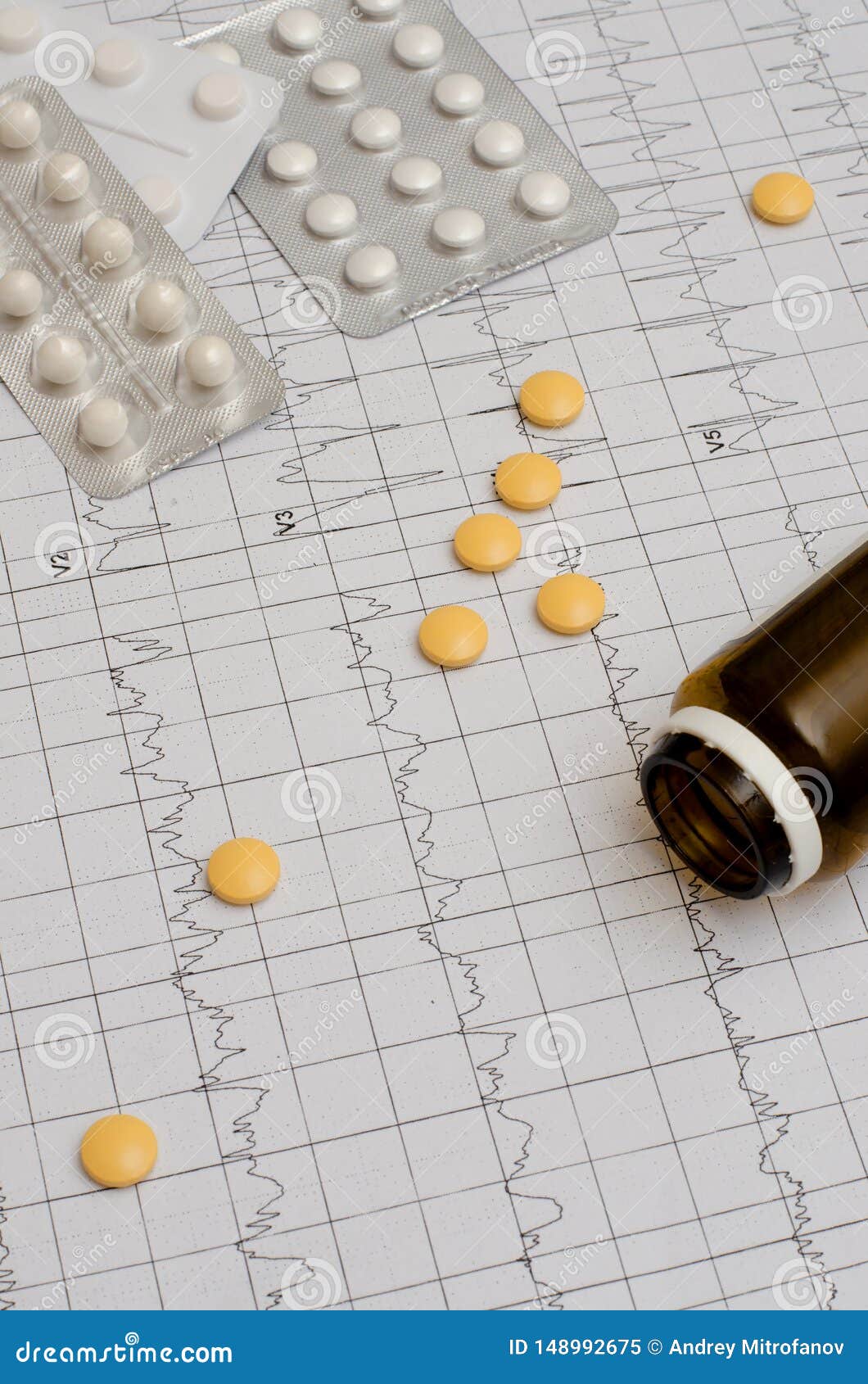 Electrocardiogram on Paper. Tablets Lie on an EKG Stock Image - Image ...