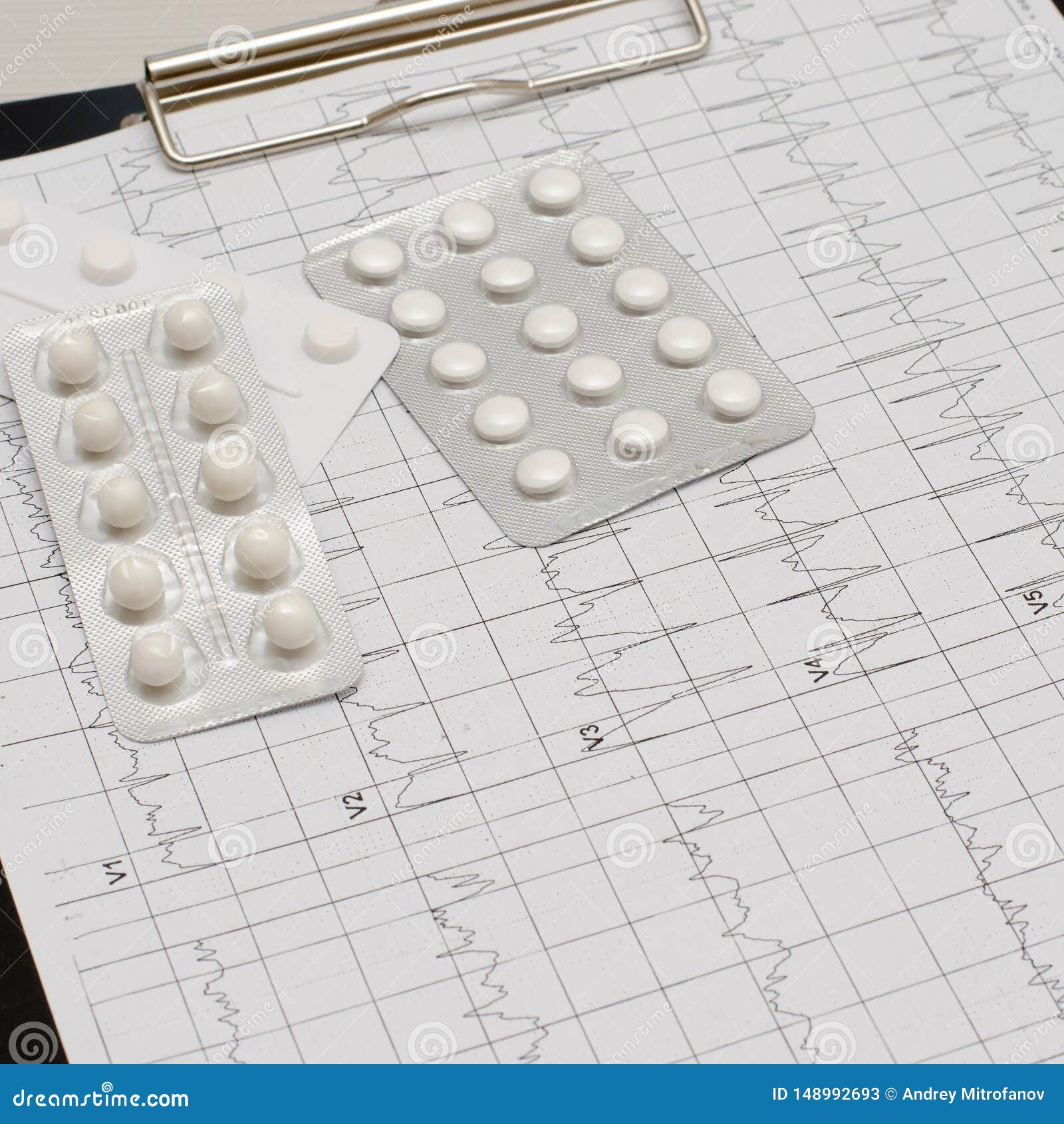 Electrocardiogram on Paper. Tablets Lie on an EKG Stock Image - Image ...