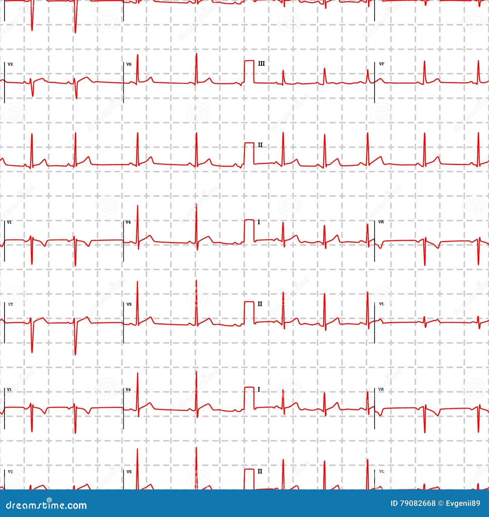 Electrocardiogram Red Graph with Marks on White, Seamless Pattern Stock ...