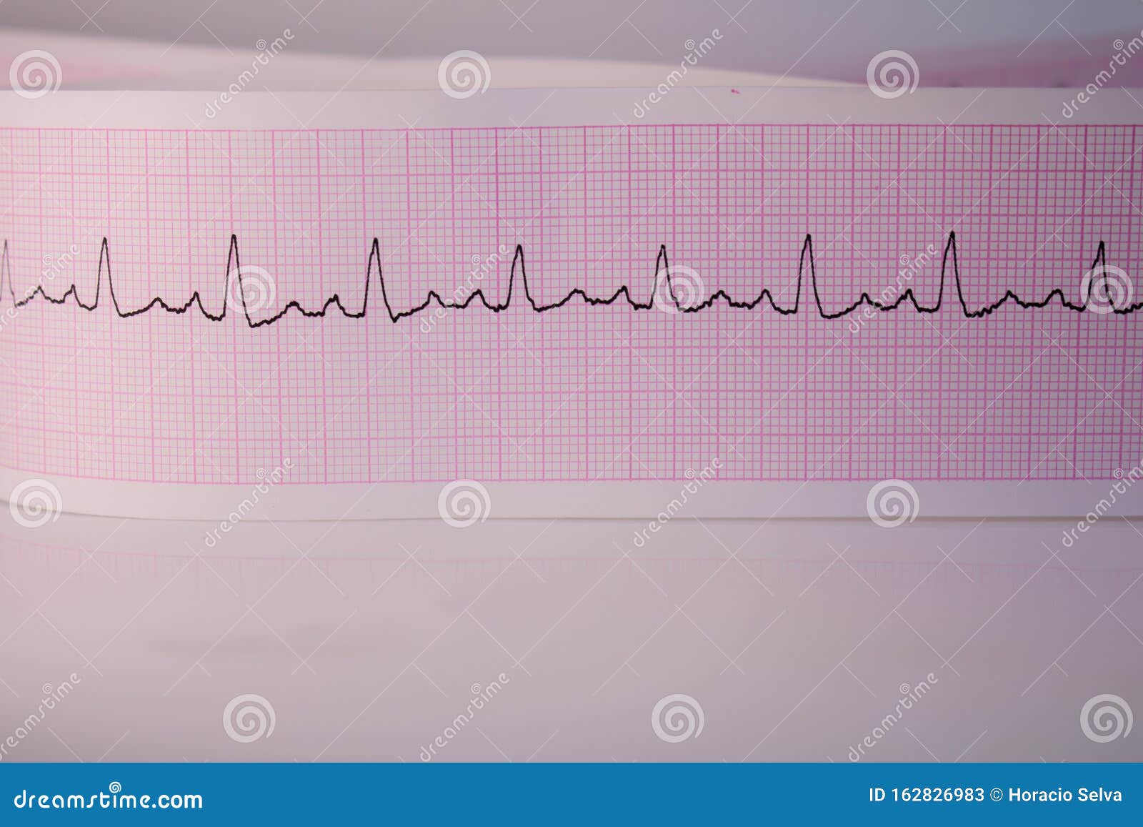 Electrocardiogram Strip On White Background Heartbeats Represented On
