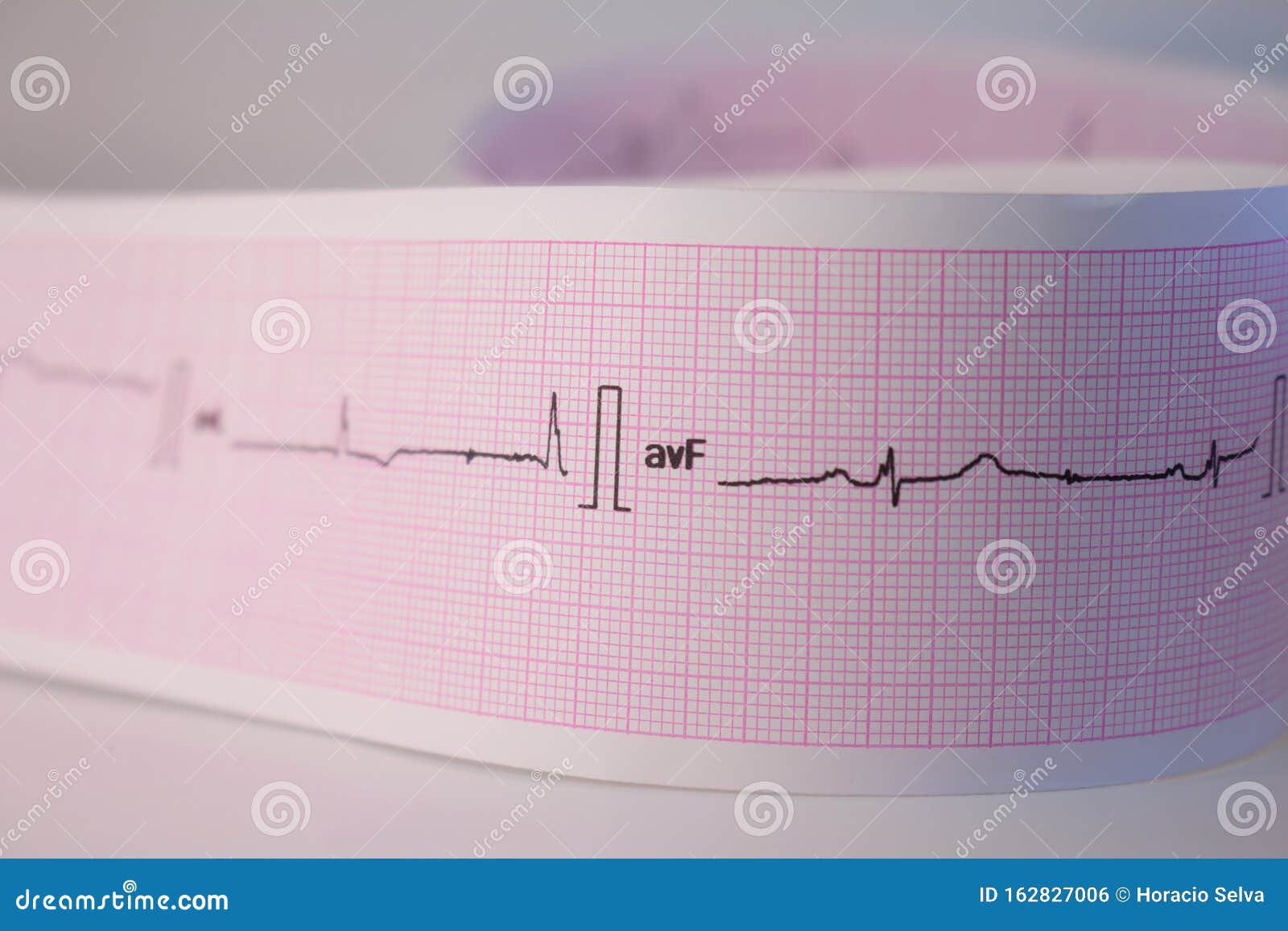 Electrocardiogram Strip On White Background Heartbeats Represented On