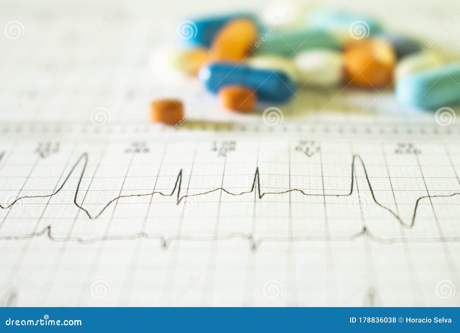 Electrocardiogram Strips with Selective Focus and Color Patterns with ...