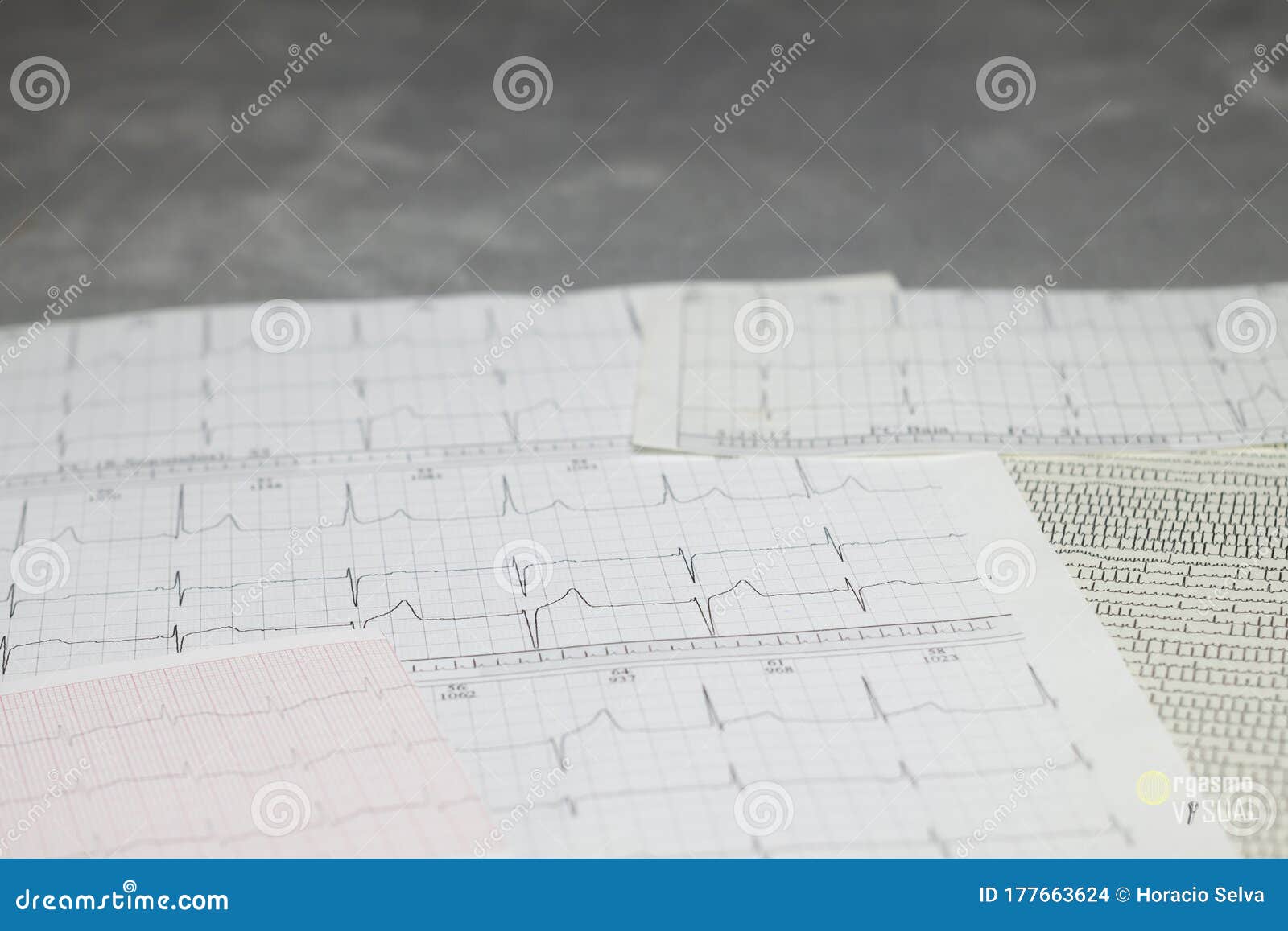 Electrocardiogram Strips with Selective Focus. Paper Traces of the ...
