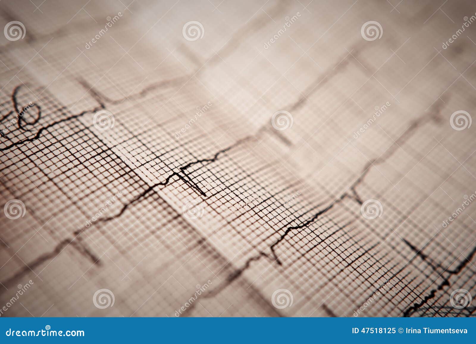 Electrocardiogram stock image. Image of close, cardiologist - 47518125