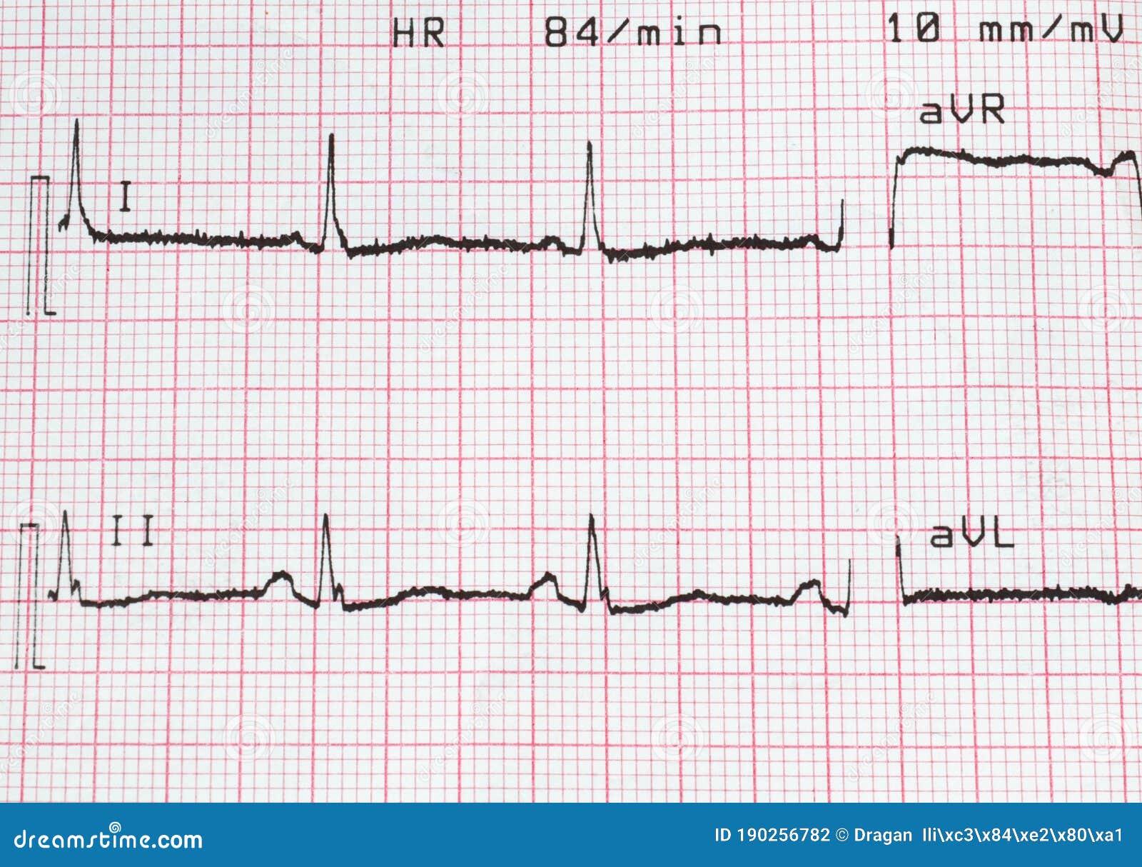 Electrocardiogram Test that - Electrical Activity of the Heart Stock ...