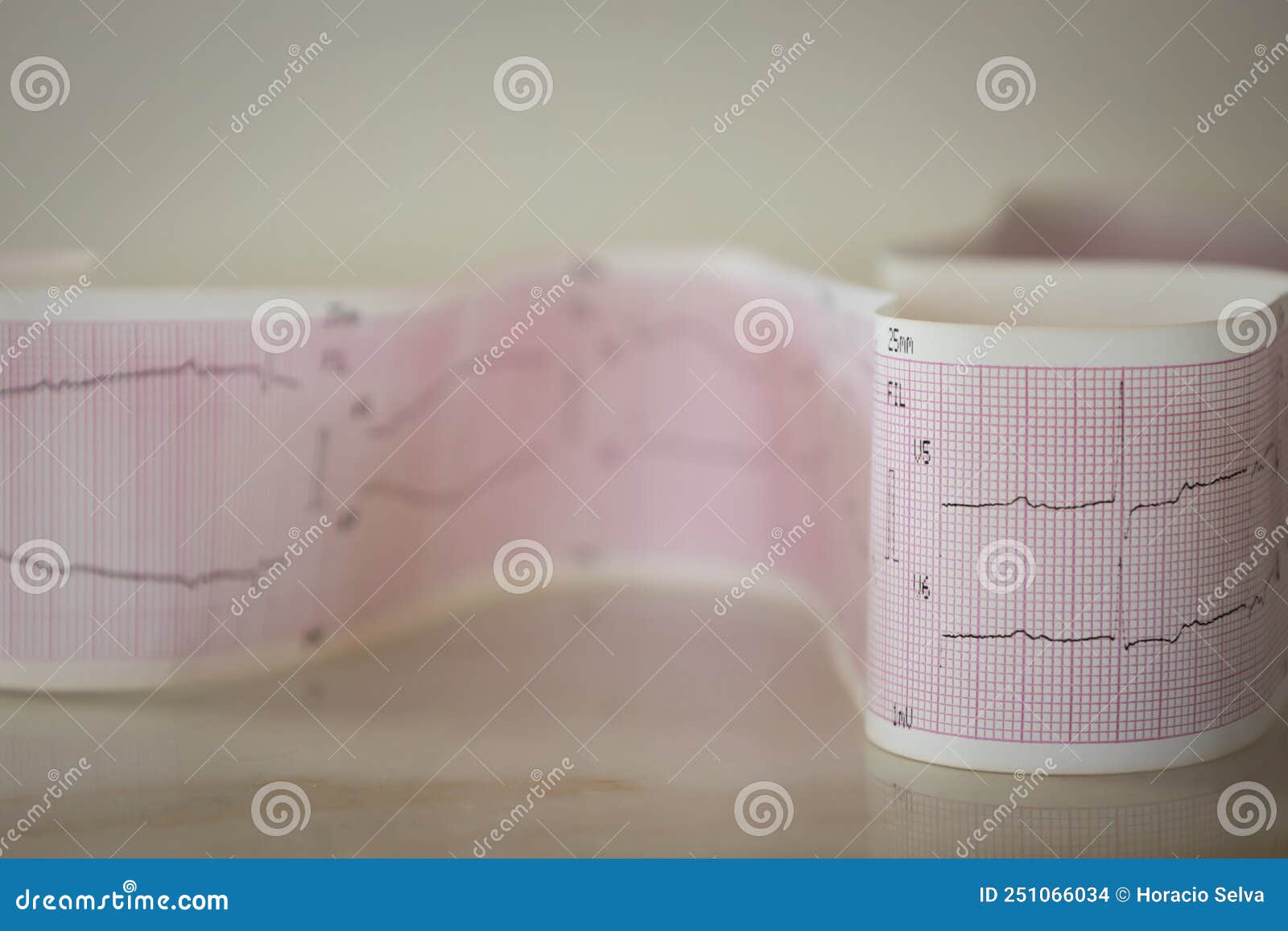 Electrocardiogram Tracing with Selective Focus on a Table. Study of the ...