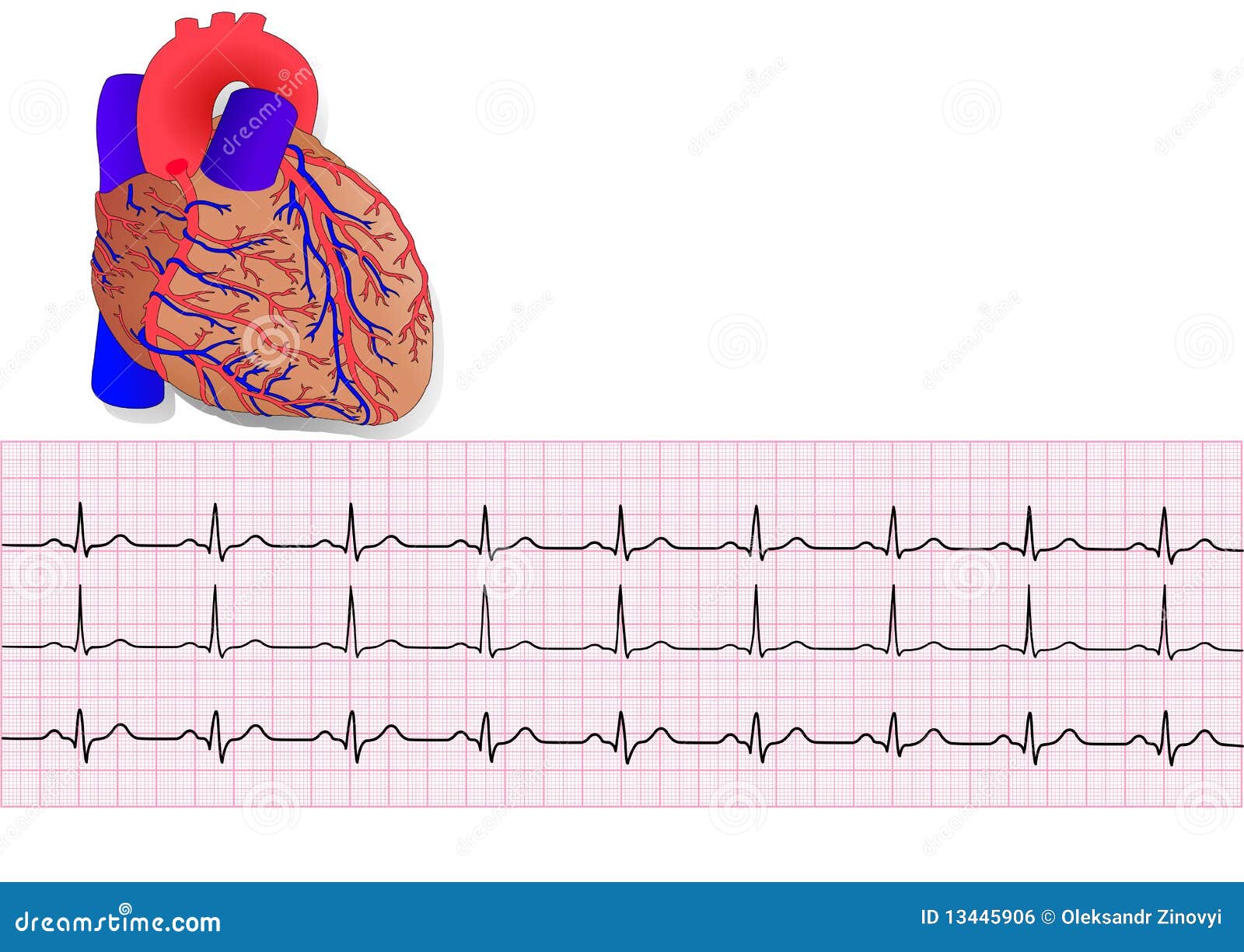 Electrocardiograma De Heart& Ilustración del Vector - Ilustración de ...