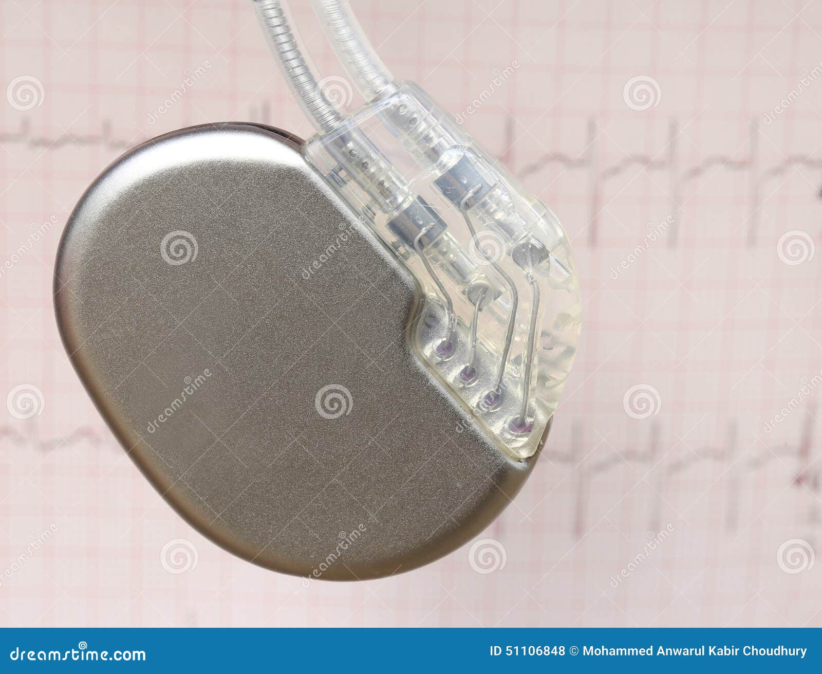 Electrocardiograph with Pacemaker Stock Photo - Image of disease, graph ...