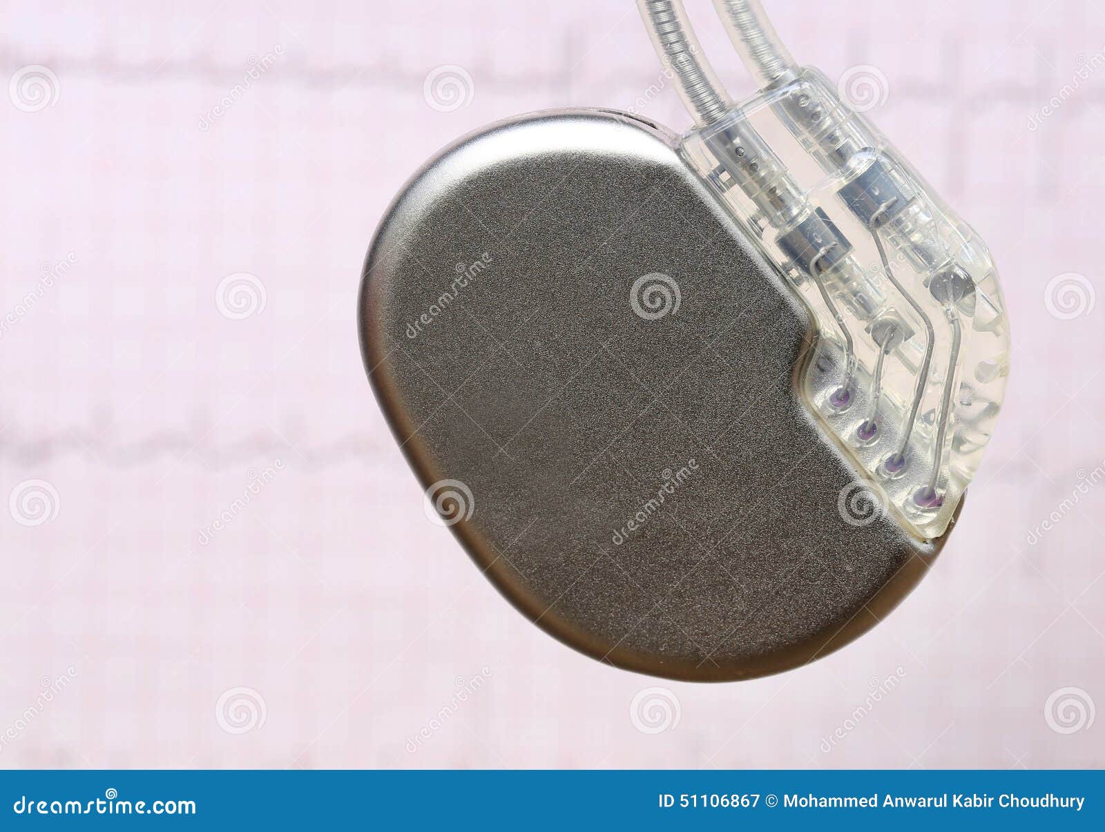 Electrocardiograph with Pacemaker Stock Image - Image of cardiovascular ...