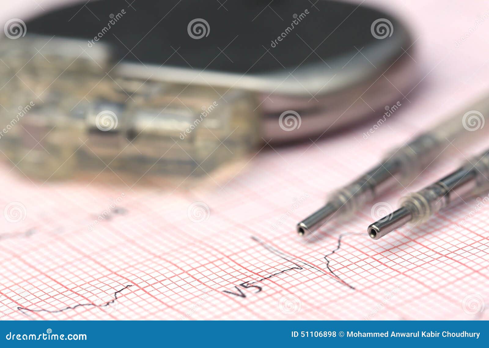 Electrocardiograph with Pacemaker Stock Photo - Image of healthcare ...