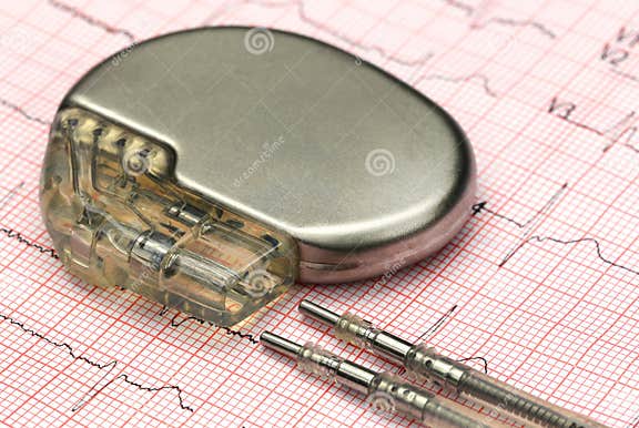 Electrocardiograph with Pacemaker Stock Photo - Image of pathology ...