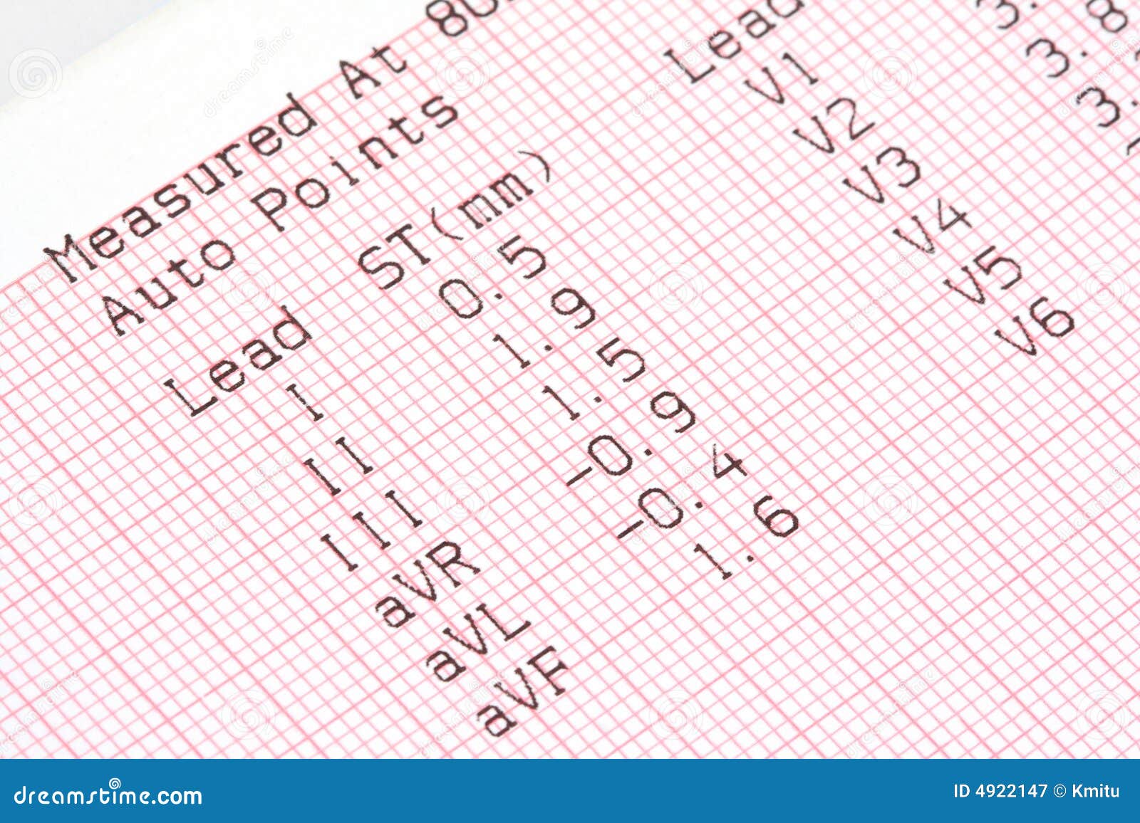 Electrocardiography Chart stock image. Image of augmented - 4922147