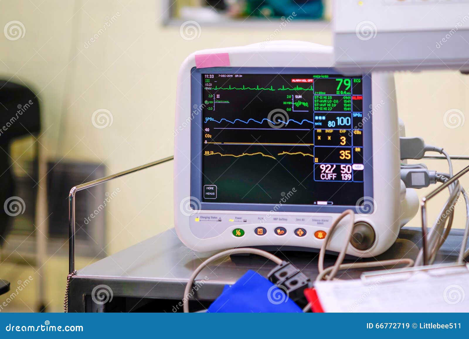 Electrocardiography in Operating Room Stock Image - Image of anesthetic ...