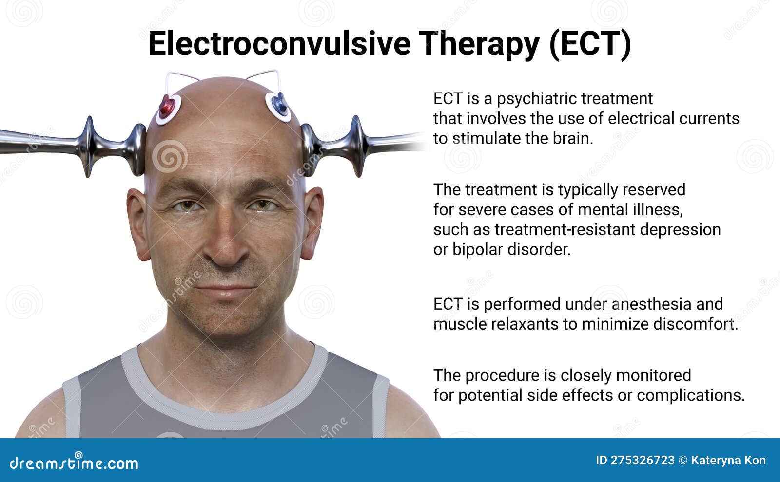 Electroconvulsive Therapy, ECT, a Treatment Involving the Use of ...