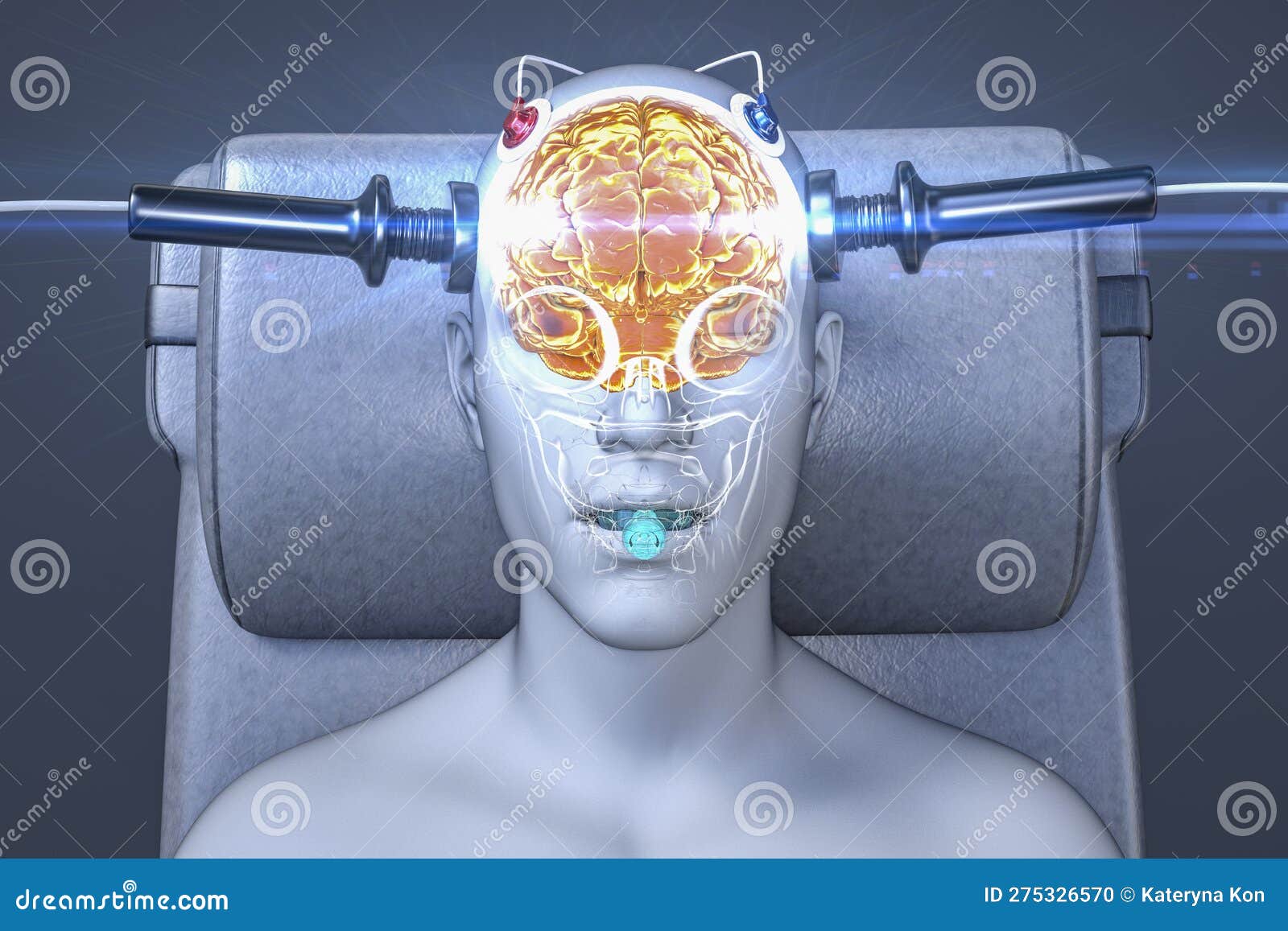 Electroconvulsive Therapy, ECT, a Treatment Involving the Use of ...