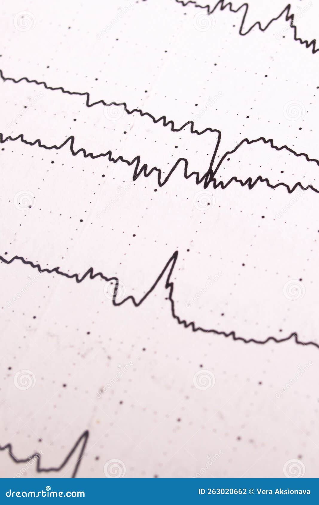 Electroencephalogram Graph on White Paper Close Up Stock Photo - Image ...