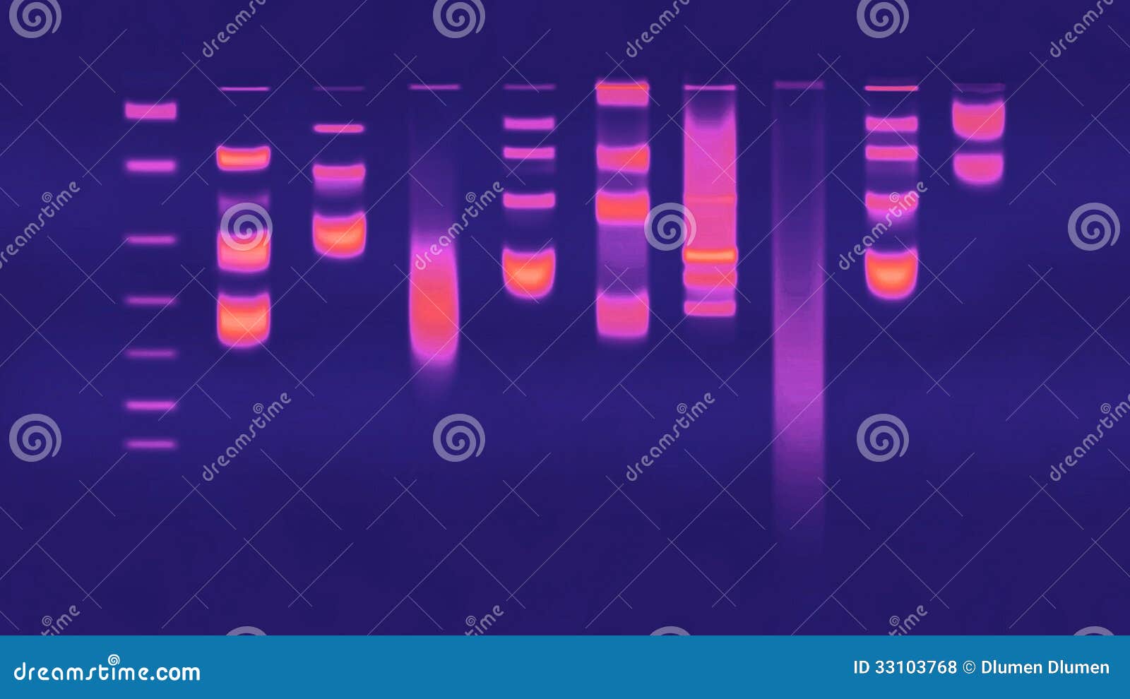 Electroforesis Del Gel De La DNA Foto de archivo - Imagen de enfermedad ...