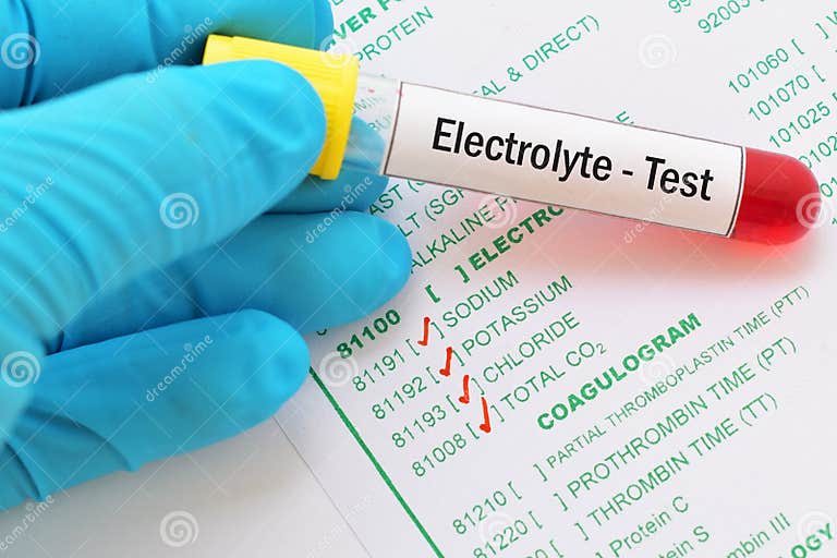 Electrolyte test stock photo. Image of experiment, anion - 103015296