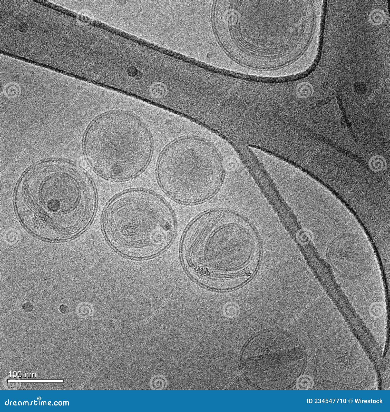 Electron Image of Nanoparticles Made of Lipids Containing an Anticancer ...