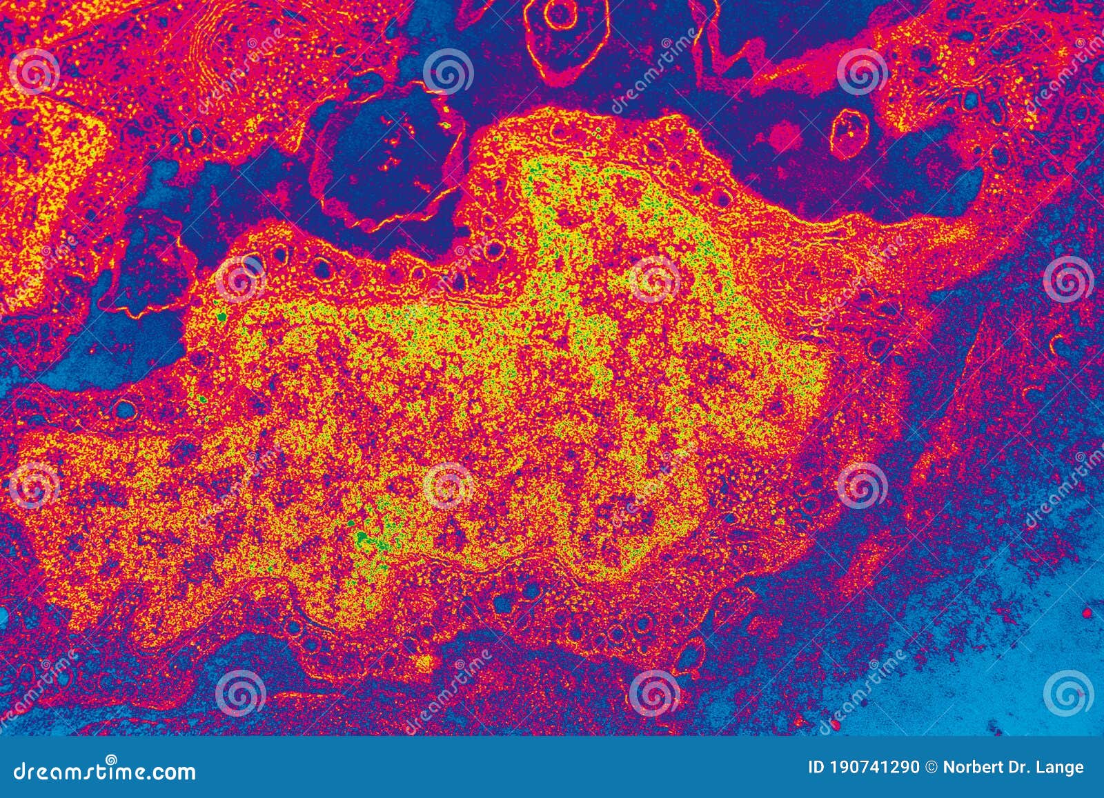 Electron Micrograph of a Cell Nucleus Stock Photo - Image of ...