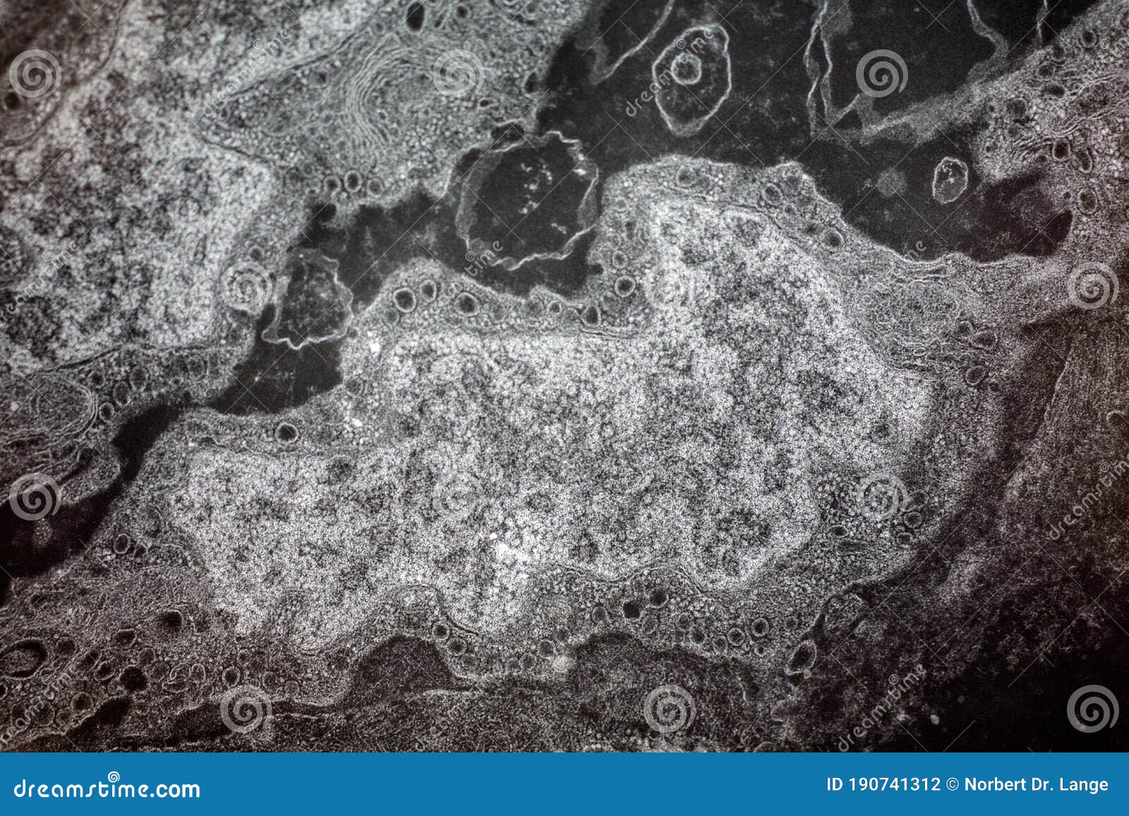 Electron Micrograph Nucleus Contains A Large Circular