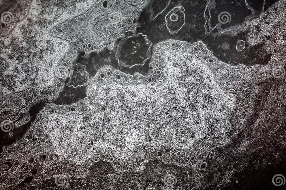 Electron Micrograph of a Cell Nucleus Stock Photo - Image of macro ...