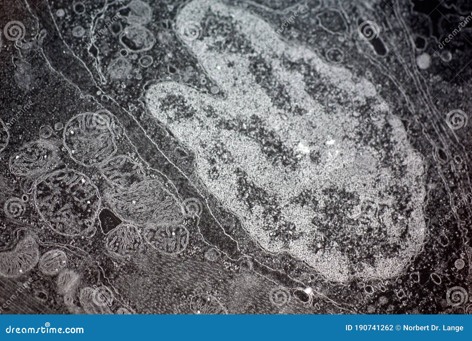 Nucleus Electron Micrograph