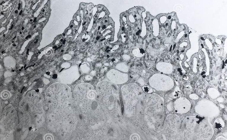 Electron Micrograph of Epithelial Tissue Stock Image - Image of mucosa ...