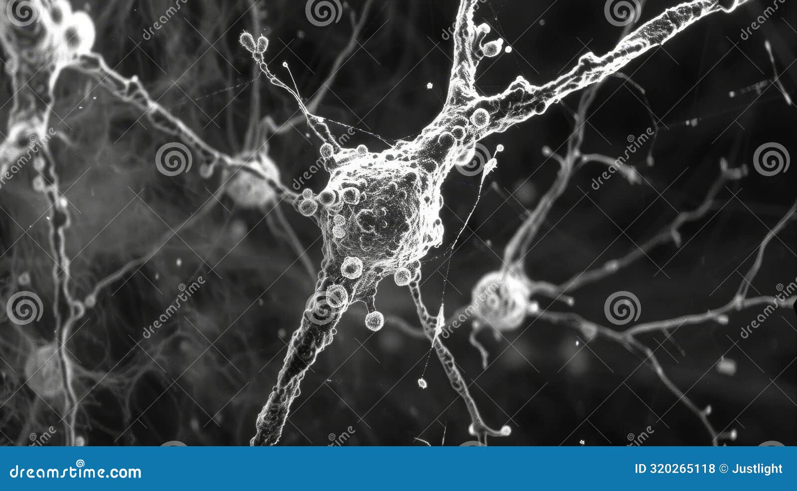 Electron Micrograph of a Synapse with Multiple Synaptic Vesicles Primed ...