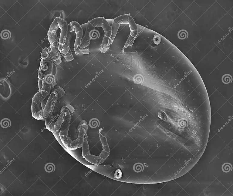 Electron microscope-mite stock image. Image of microscope - 32658399