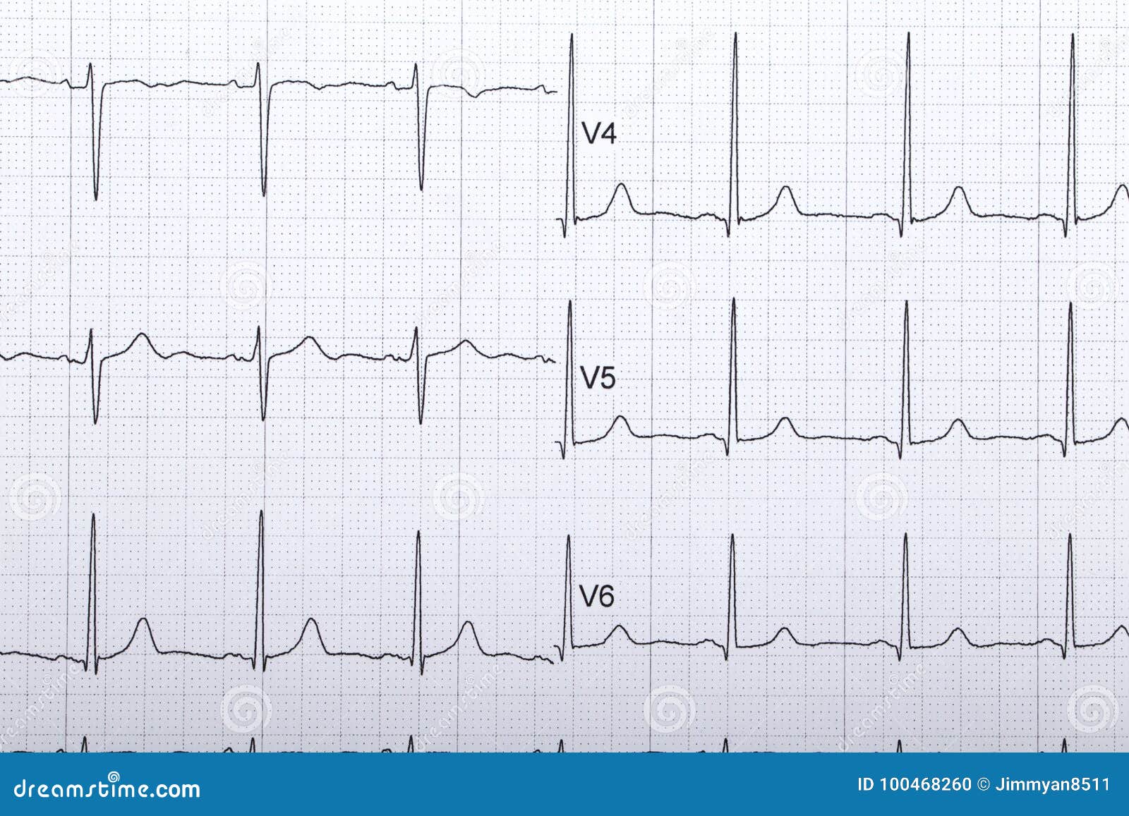 Elektrocardiogram stock foto. Image of grafiek, gezond - 100468260