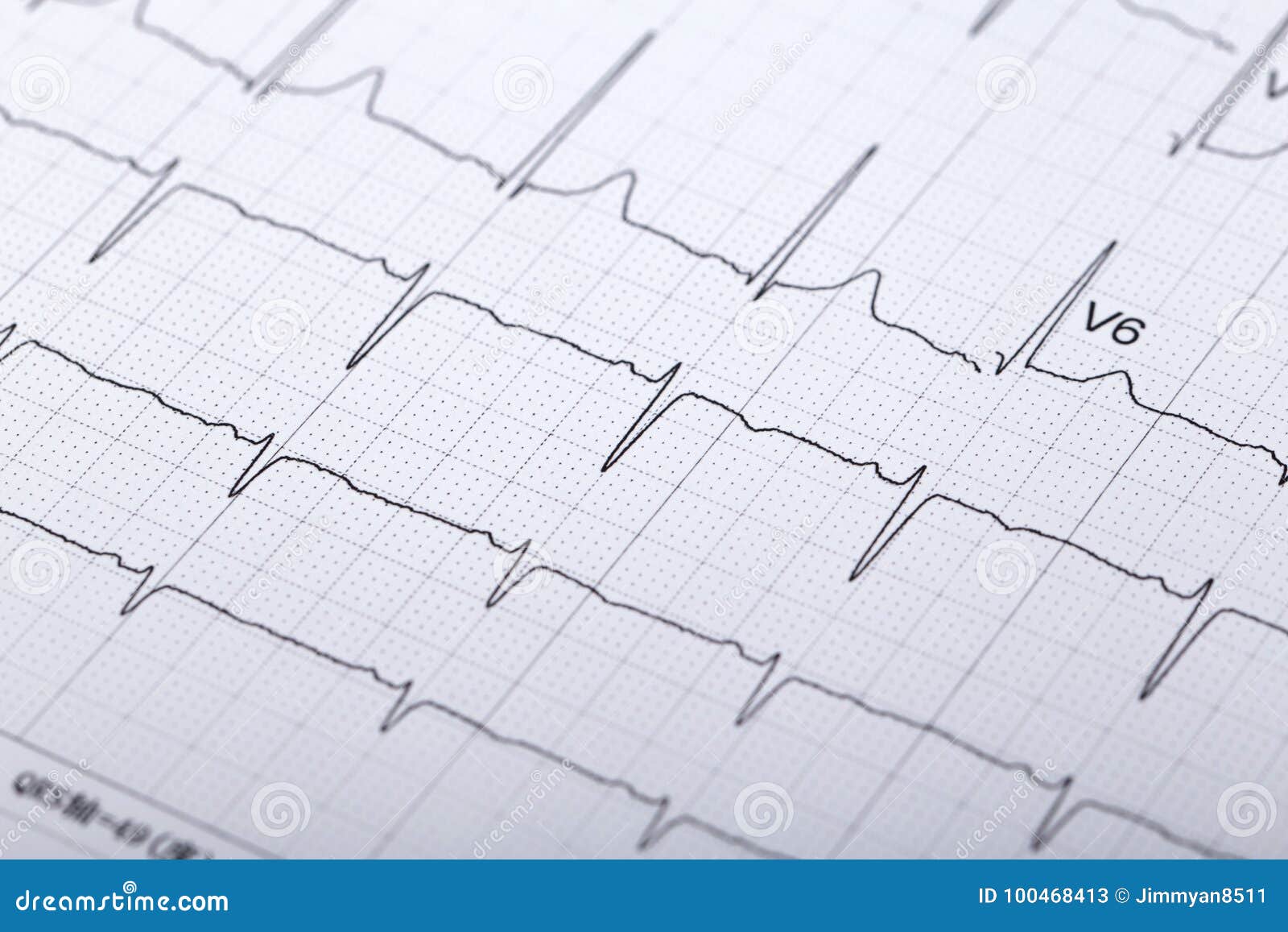 Elektrocardiogram stock afbeelding. Image of kardiogram - 100468413