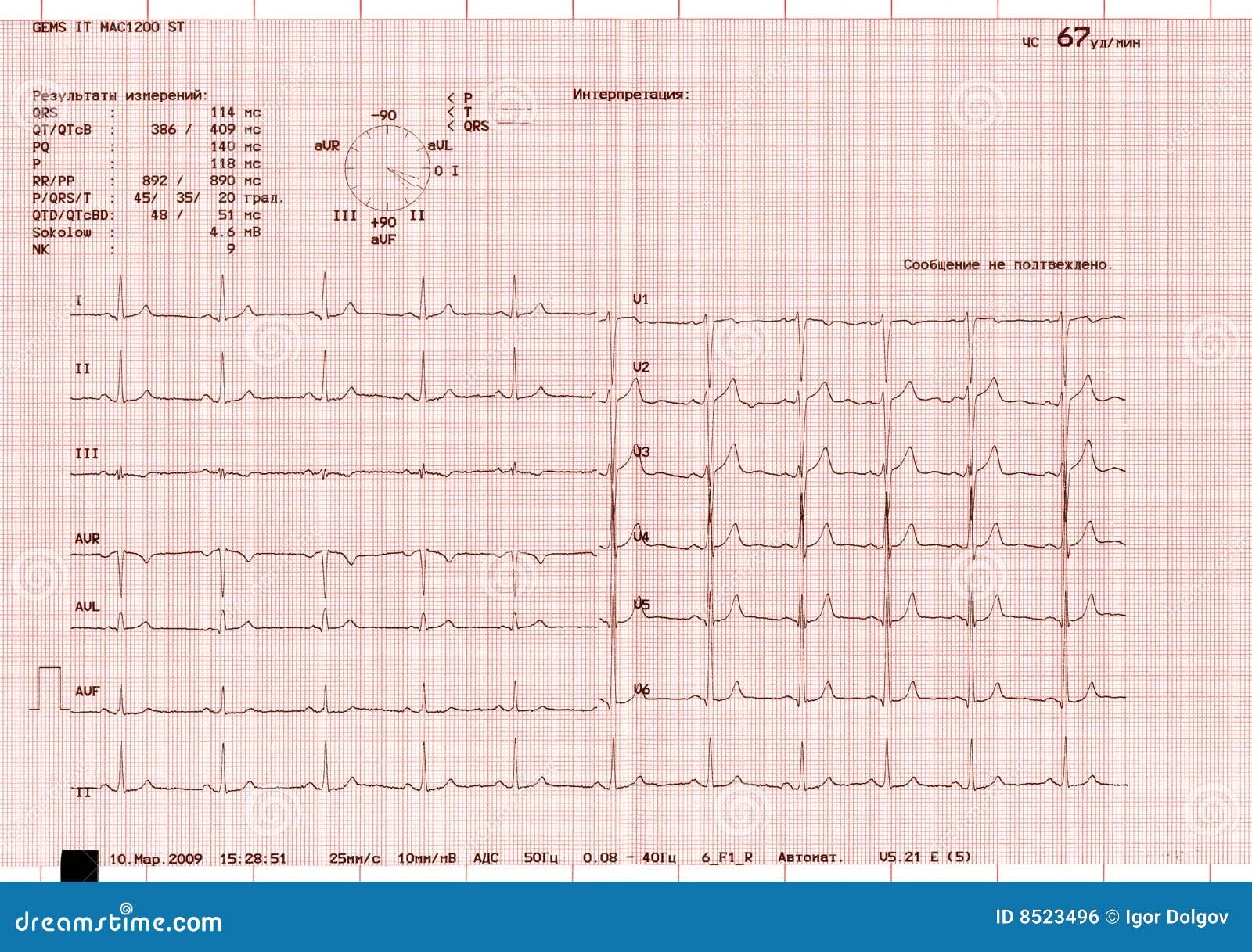Elektrocardiogram stock illustratie. Illustration of meting - 8523496