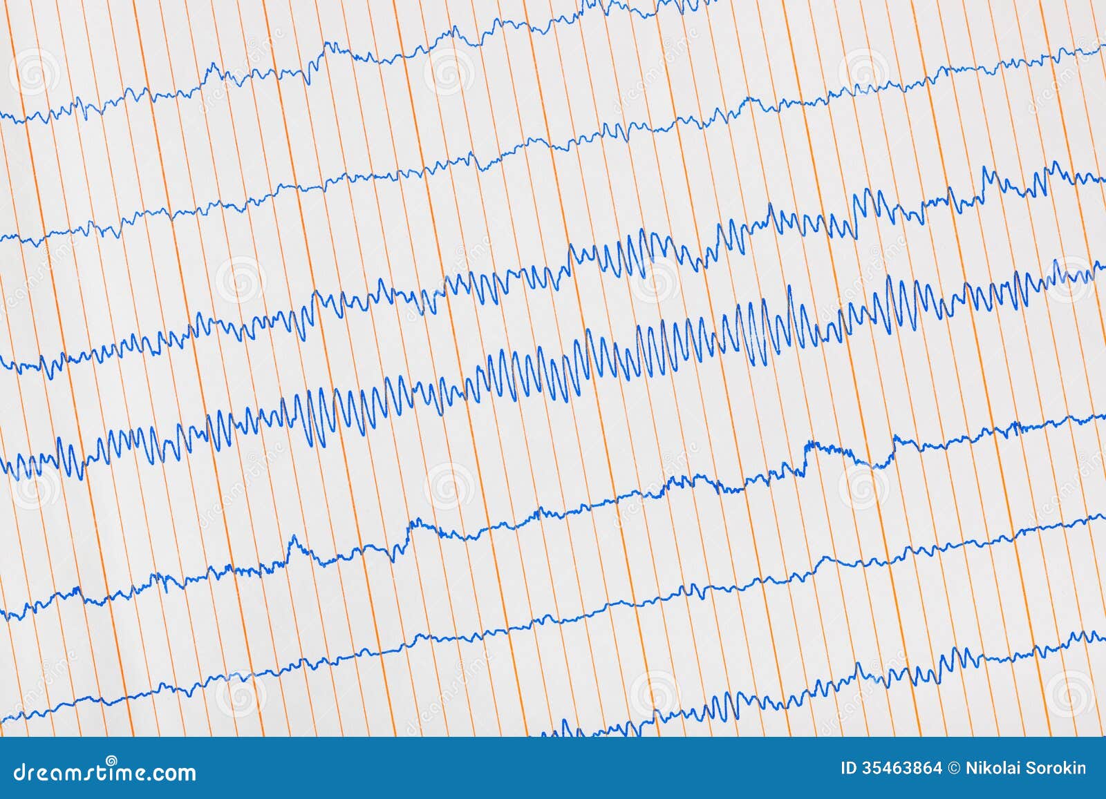 Elektrocardiogram ecg stock foto. Image of hartslag, uitprinten - 35463864
