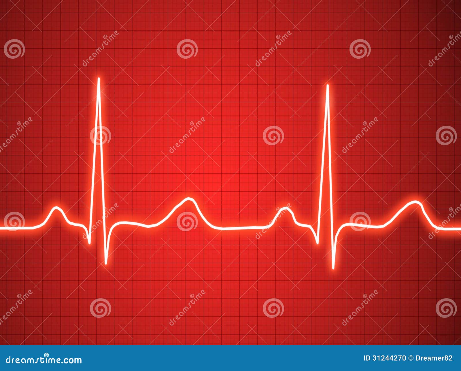 Elektrocardiogram, Ecg, Grafiek, Impuls Het Vinden Stock Illustratie ...
