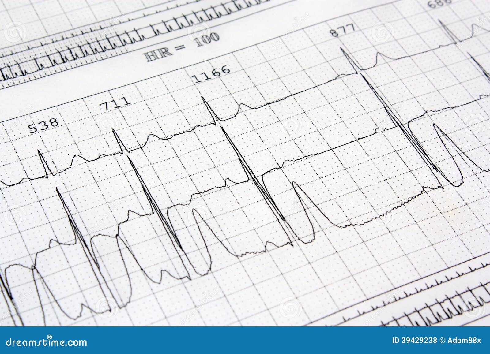 Elektrocardiogram ekg hart stock foto. Image of uitprinten - 39429238