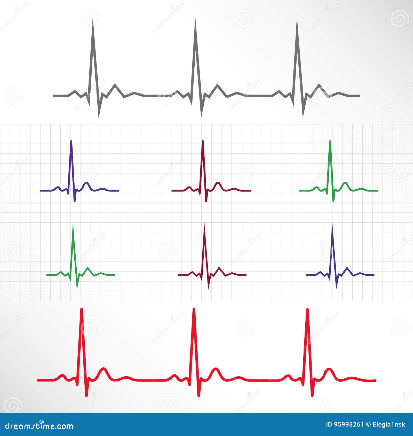Electrocardiograma Normal