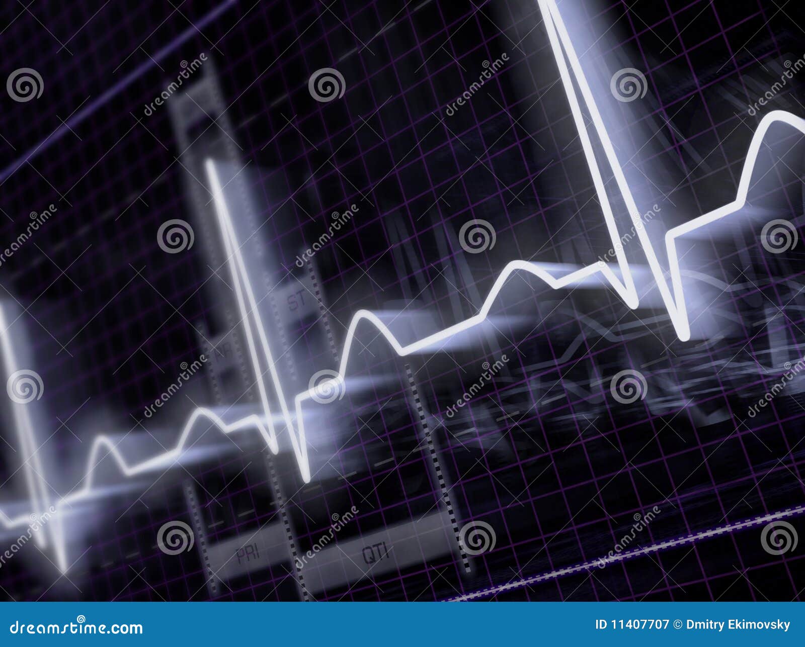 Elettrocardiogramma illustrazione di stock. Illustrazione di ...