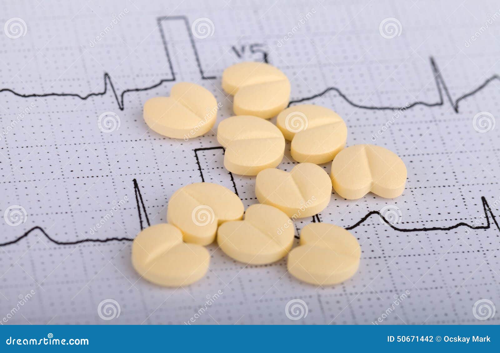 Elettrocardiogramma fotografia stock. Immagine di colorato - 50671442