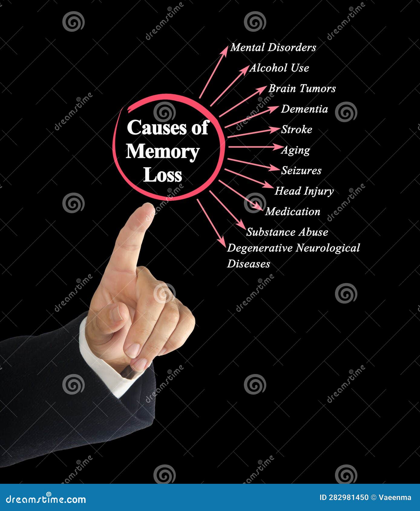 Causes of Memory Loss stock photo. Image of concept - 282981450
