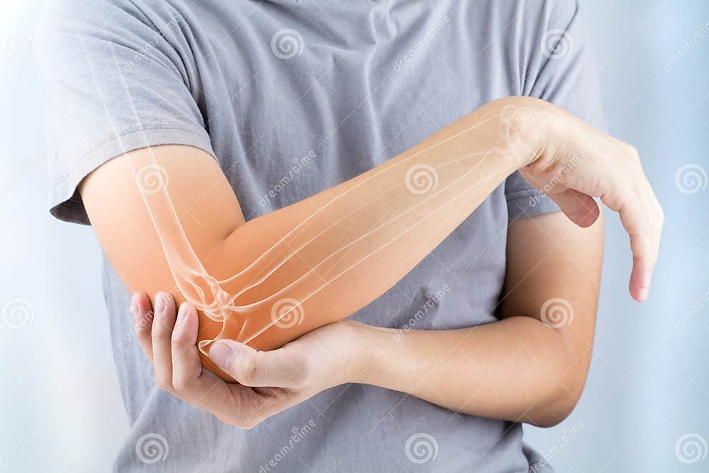 Ellbogen Entbeint Verletzung Stockbild - Bild von verbindungen ...